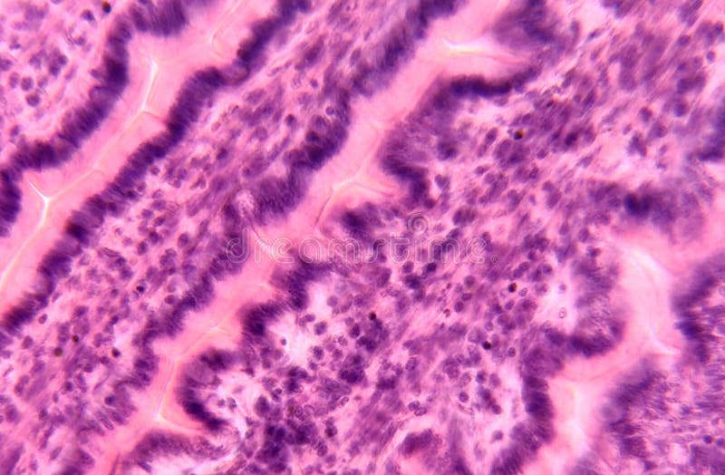 Intestinal Villi Under a Microscope Stock Photo - Image of ciliated ...
