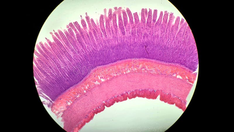 Intestinal Villi Under a Microscope Stock Photo - Image of anatomy ...