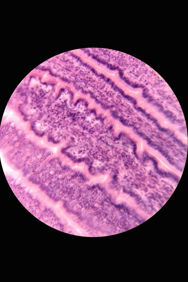 Intestinal Villi Under a Microscope Stock Photo - Image of anatomy ...