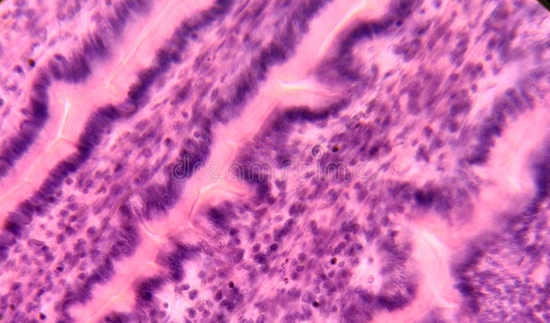 Intestinal Villi Under a Microscope Stock Photo - Image of body ...