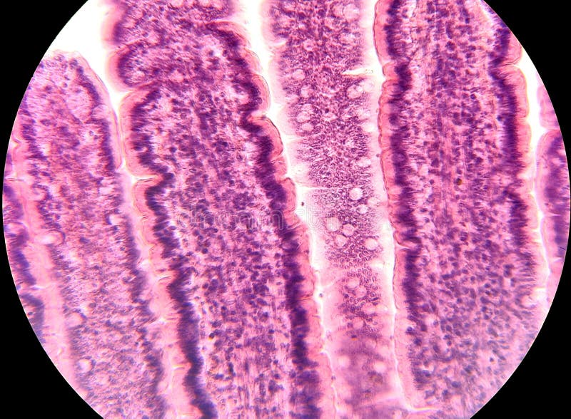 542 Intestinal Cells Stock Photos - Free & Royalty-Free Stock Photos ...