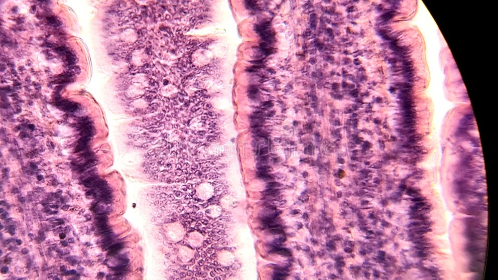 Intestinal Villi Under a Microscope Stock Image - Image of prismatic ...