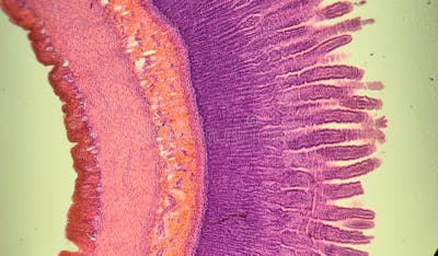 Intestinal Villi Under a Microscope Stock Photo - Image of microscope ...