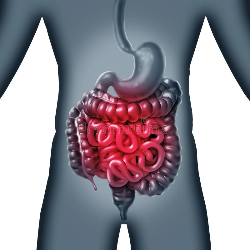 Begrip darmpijn vector illustratie. Illustration of rectum - 228593330