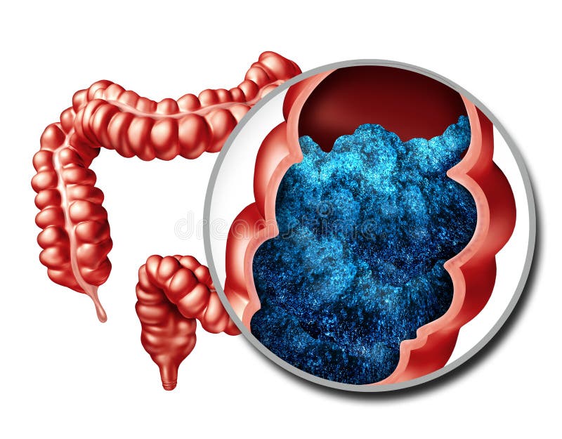 Constipation Stock Illustrations – 6,824 Constipation Stock ...