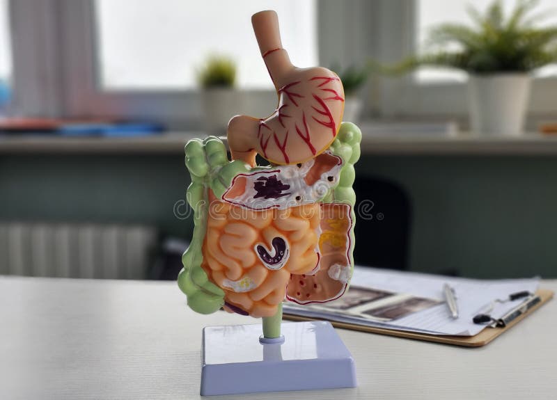 Intestine or Bowel Human Anatomy Model for Study Education Concept ...