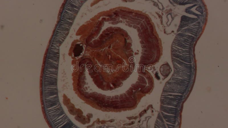 Intestine of the Earthworm in Cross Section Stock Footage - Video of ...