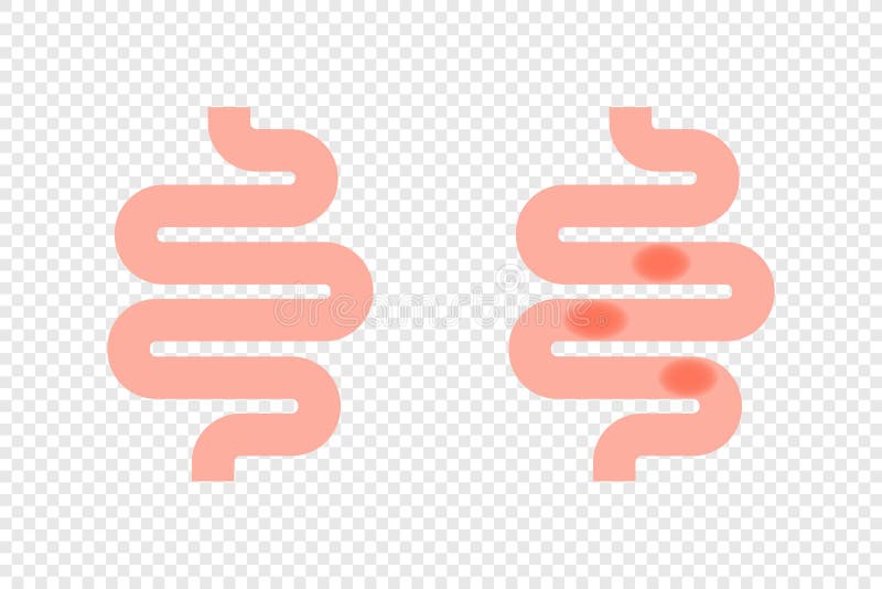 Intestines and Bowel Ache. Colitis Vector Icon Stock Illustration ...