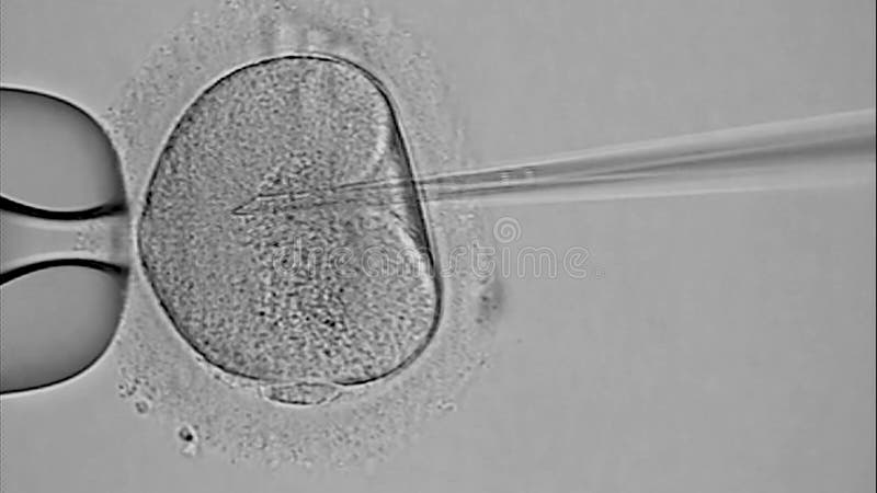 Intracytoplasmic Sperm Injection. Vitro Fertilisation Process. Stock ...
