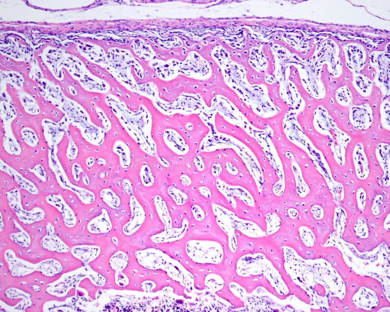 Intramembranous Ossification Stock Image - Image of histology ...