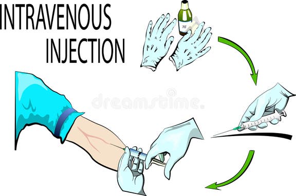 Intraveneuze injectie vector illustratie. Illustration of beschrijving ...