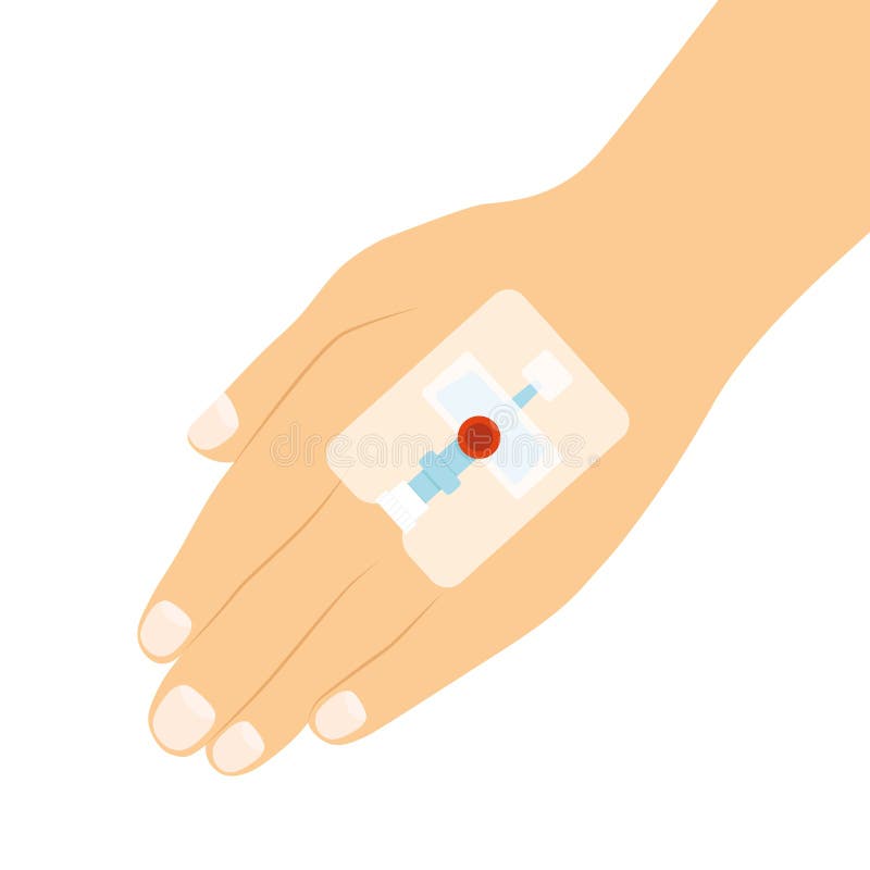 Intravenous Cannula Stock Illustrations – 121 Intravenous Cannula Stock ...