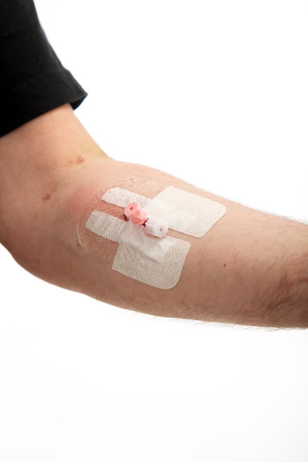 Intravenous Needle Inserted in a Vein Stock Image - Image of plaster ...