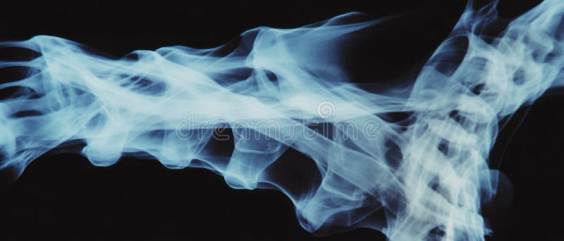 Intricate Layered X-ray Texture Creating a Complex and Dimensional ...