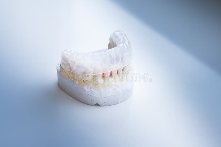 Invisalign, Invisible Plastic Teeth Aligner Stock Photo - Image of ...