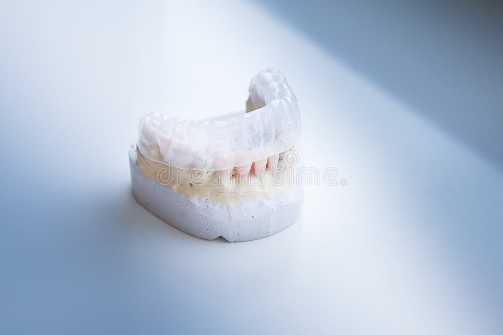 Invisalign, Invisible Plastic Teeth Aligner Stock Photo - Image of ...