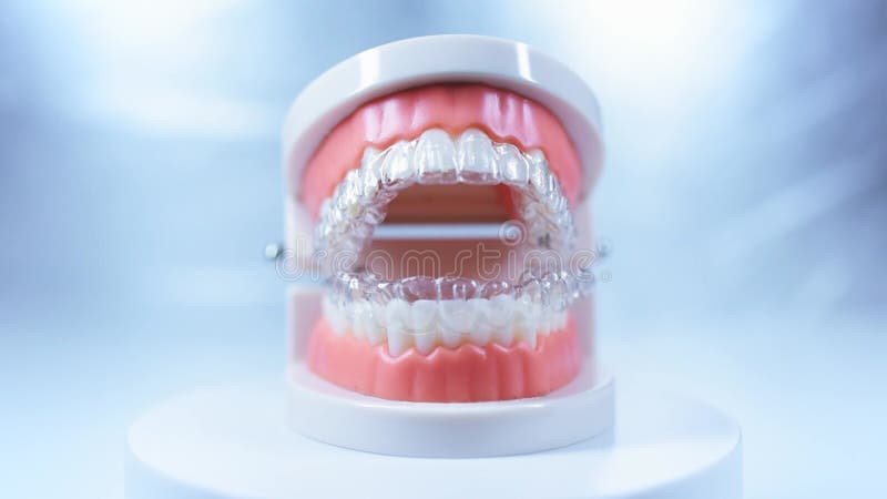 Invisible Dental Braces Teeth Aligners with Light Effects. Plastic ...