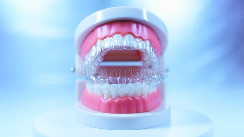 Invisible Dental Braces Teeth Aligners with Light Effects. Plastic ...