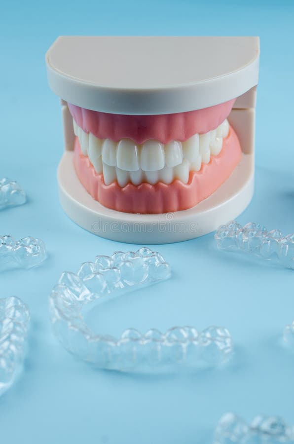 Invisible and Removable Aligners for Teeth Alignment on a Blue ...
