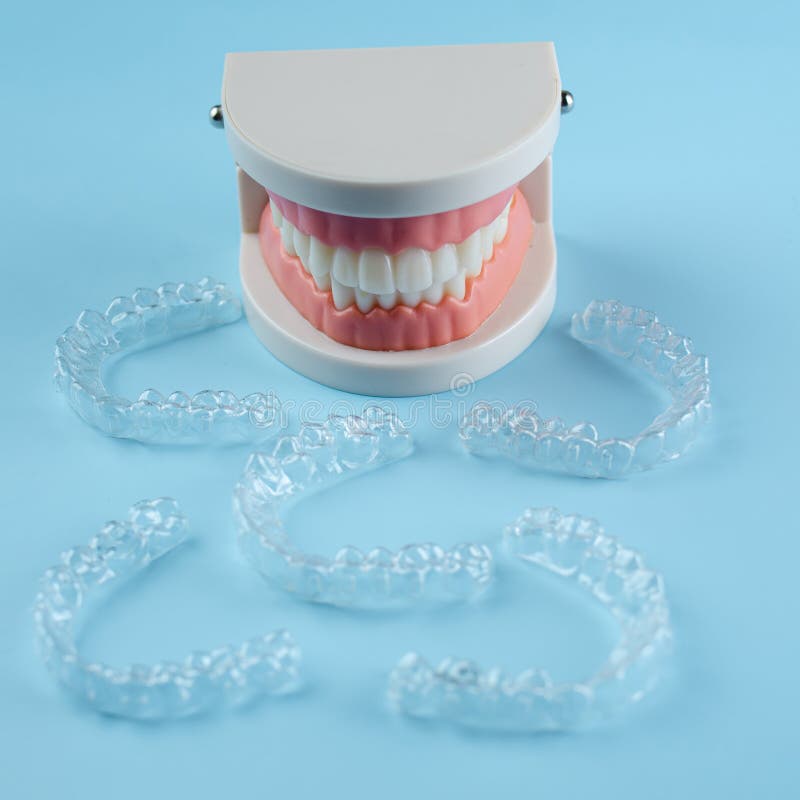Invisible and Removable Aligners for Teeth Alignment on a Blue ...