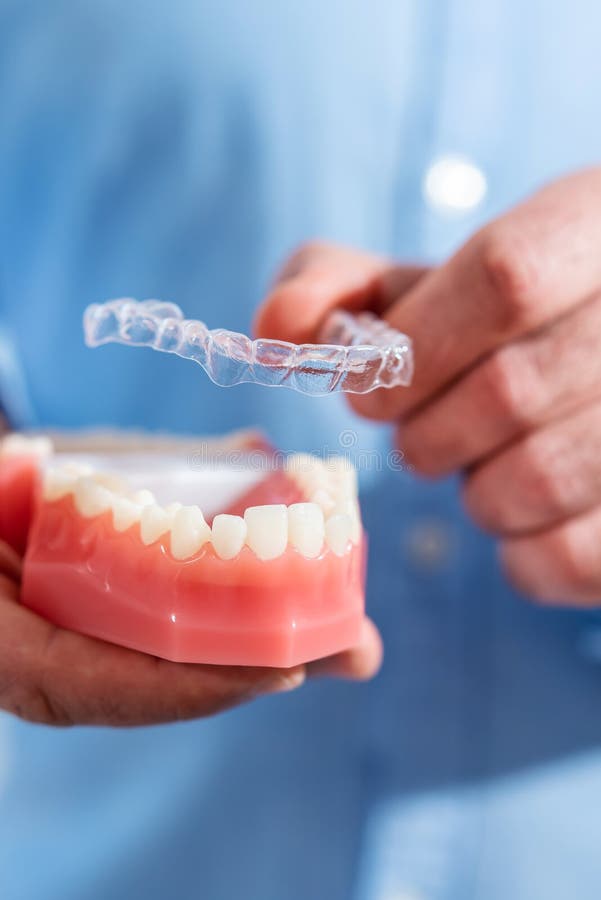 Invisible and Removable Aligners for Teeth Alignment Stock Image ...