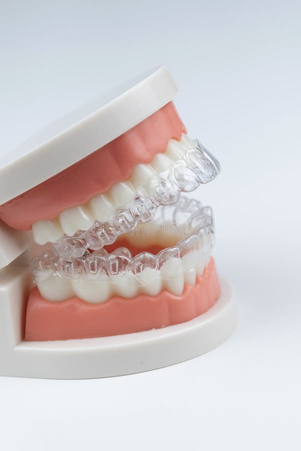 Invisible and Removable Aligners for Teeth Alignment Stock Photo ...