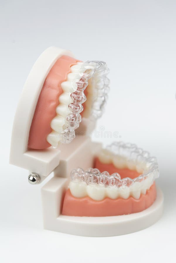 Invisible and Removable Aligners for Teeth Alignment Stock Photo ...