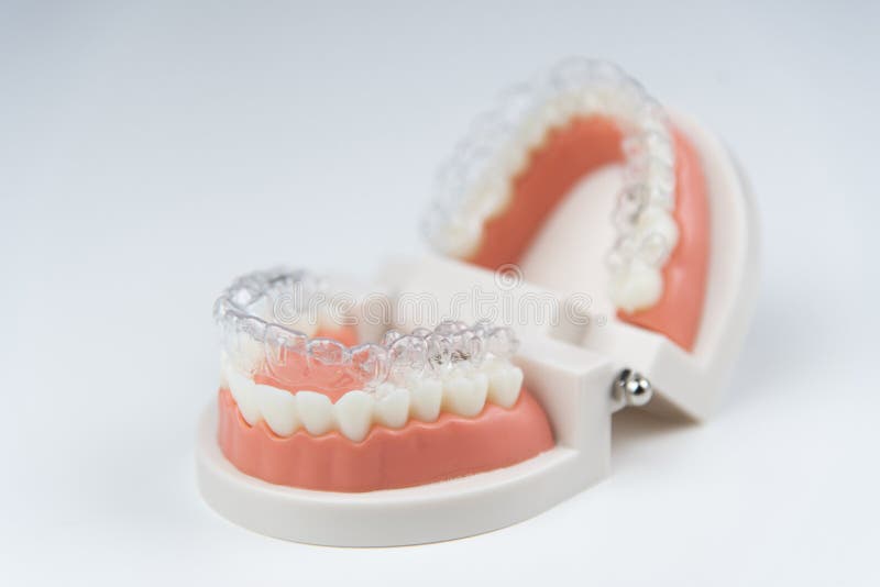 Invisible and Removable Aligners for Teeth Alignment Stock Photo ...