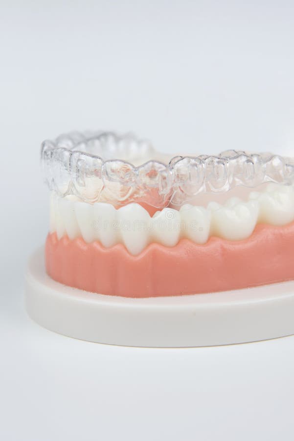 Invisible and Removable Aligners for Teeth Alignment Stock Image ...