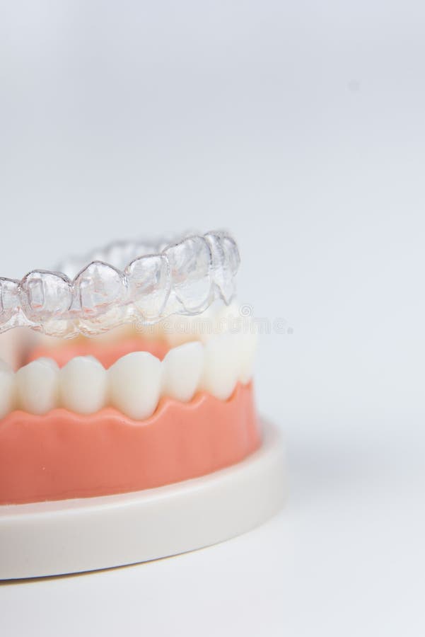Invisible and Removable Aligners for Teeth Alignment Stock Photo ...