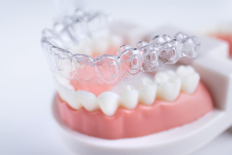 Invisible and Removable Aligners for Teeth Alignment Stock Image ...