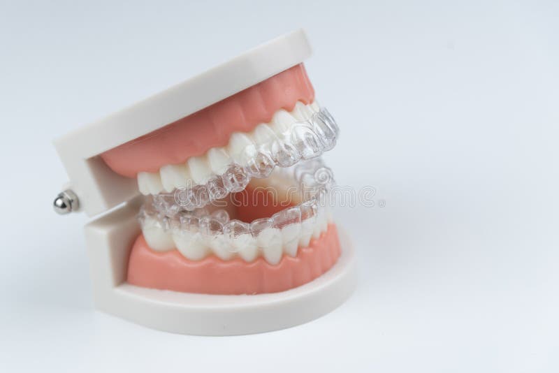 Invisible and Removable Aligners for Teeth Alignment Stock Image ...