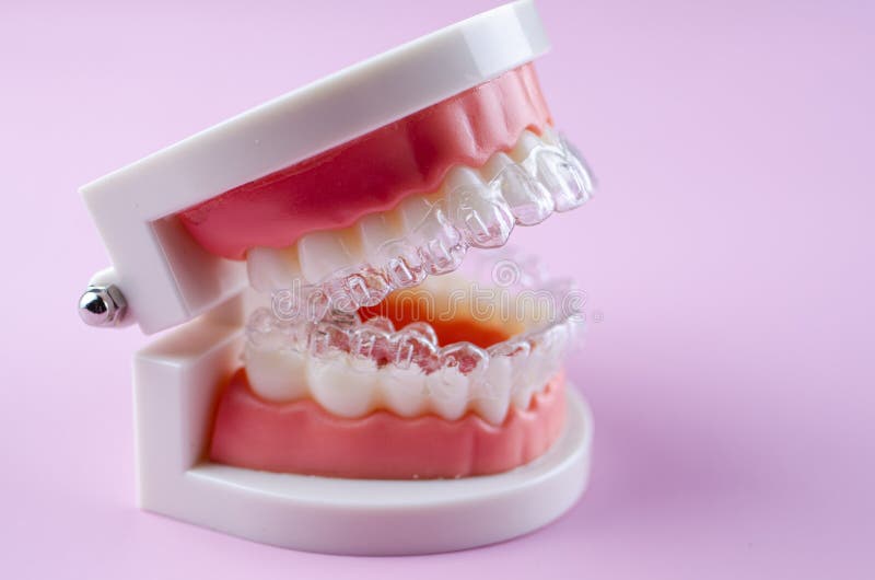 Invisible and Removable Aligners for Teeth Alignment on a Pink ...