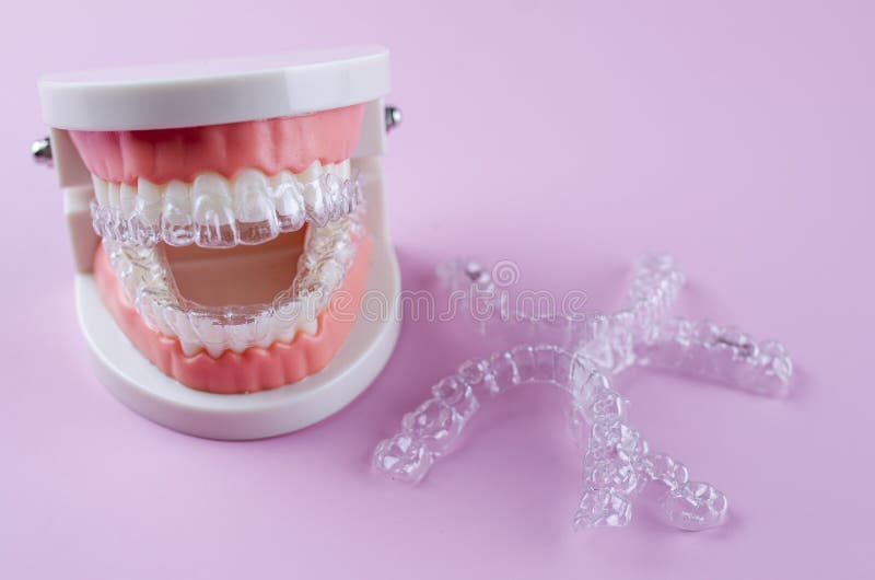 Invisible and Removable Aligners for Teeth Alignment on a Pink ...