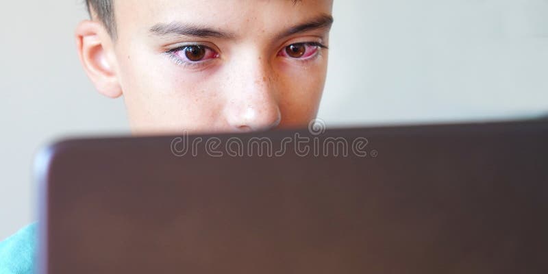 Irritated Eyes of Teenage Boy while Using His Laptop in Deep ...