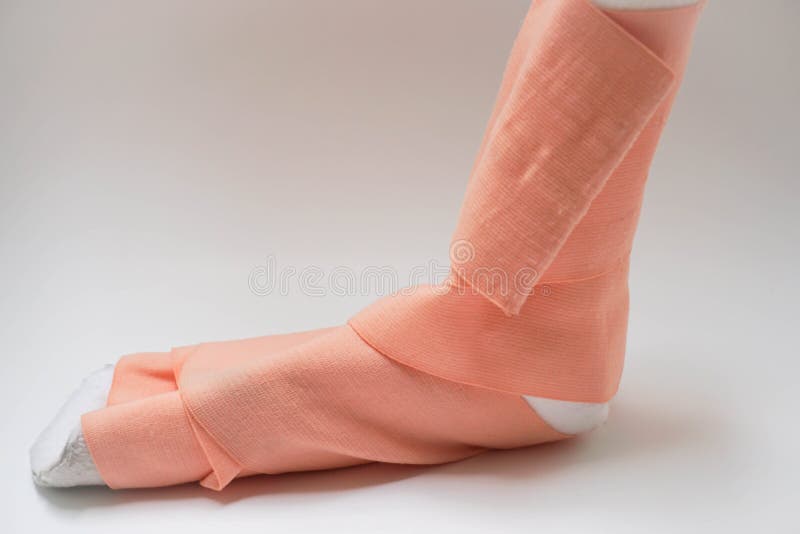 Isolate White Leg Splint Wrapped with Bandage Stock Image - Image of ...