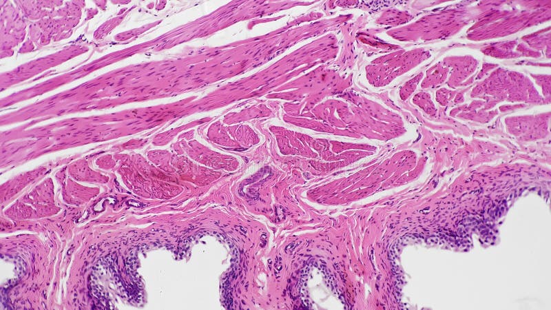 Isolated Macro Slide Human Bladder Sample in Section Magnified in 100 ...