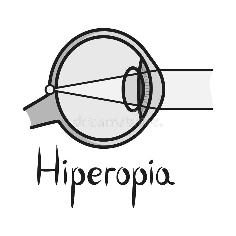 Hyperopia Vector Stock Illustrations – 431 Hyperopia Vector Stock ...