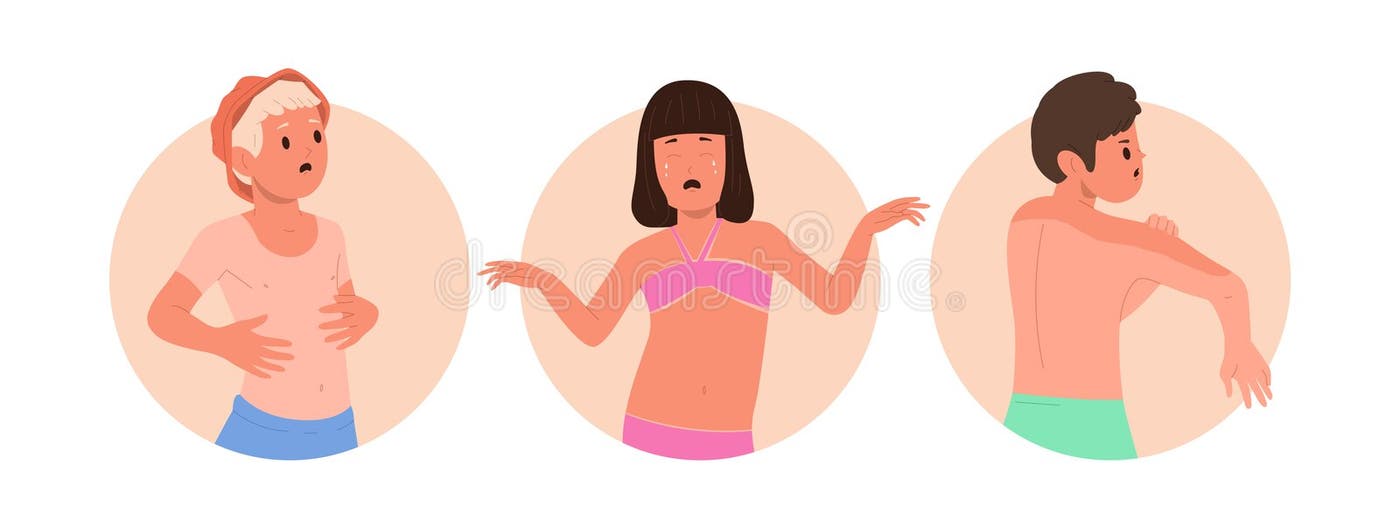 Cartoon Sunburned Stock Illustrations 91 Cartoon Sunburned Stock