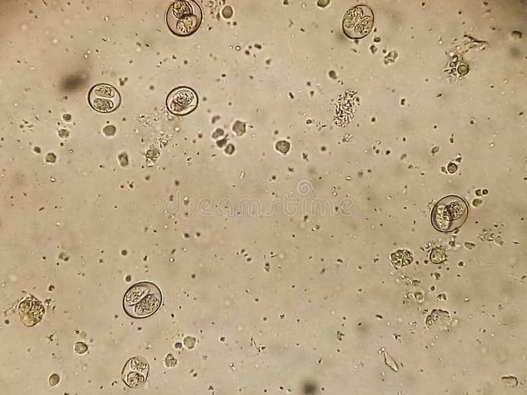 Isospora Spp. Oocysts from Cat`s Faeces Under the Microscope Stock ...
