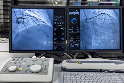 Istanbul, Turkey 28 February 2024 Angiogram Sequence Working Clockwise ...