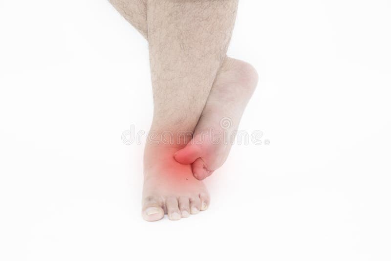 1,183 Foot Rash Stock Photos - Free & Royalty-Free Stock Photos from ...