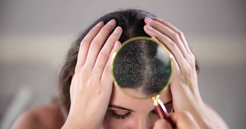 Itchy Head Scalp stock image. Image of lady, hormonal - 277196255