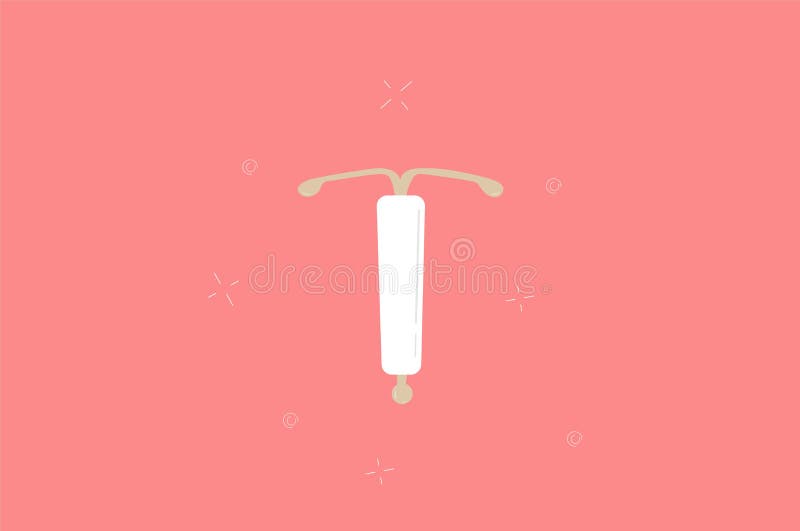 Birth Control Iud Stock Illustrations – 200 Birth Control Iud Stock ...