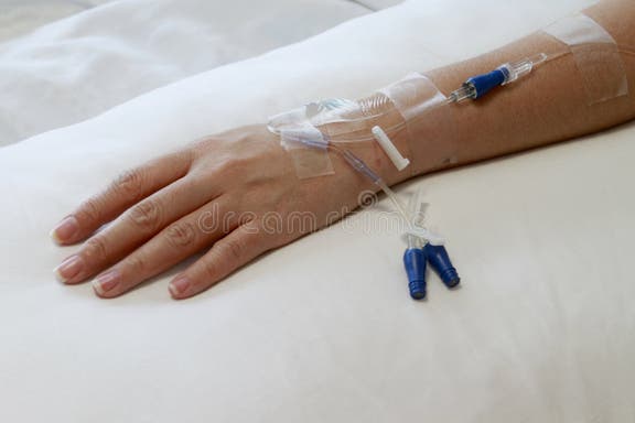 IV Drip stock image. Image of hospital, rehydrate, rehydration - 21851827