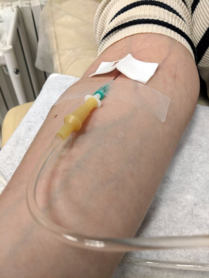 10,846 Needle Arm Photos - Free & Royalty-Free Stock Photos from Dreamstime