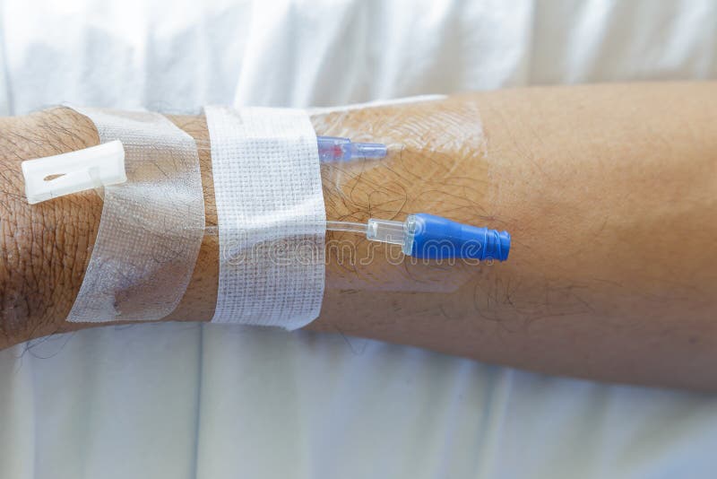 IV Needle on Patient Arm for Medicine Injection Stock Photo - Image of ...