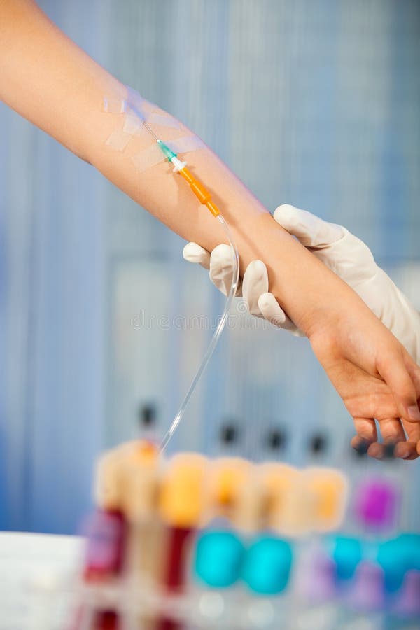 IV Solution in a Patient Hand Stock Photo - Image of droplet, care ...
