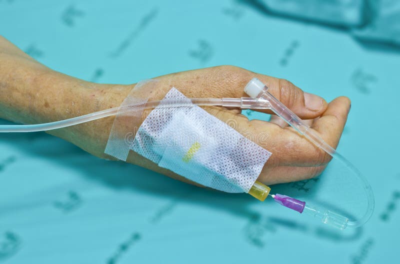 IV Solution in a Patients Hand. Stock Image - Image of hand, anesthetic ...