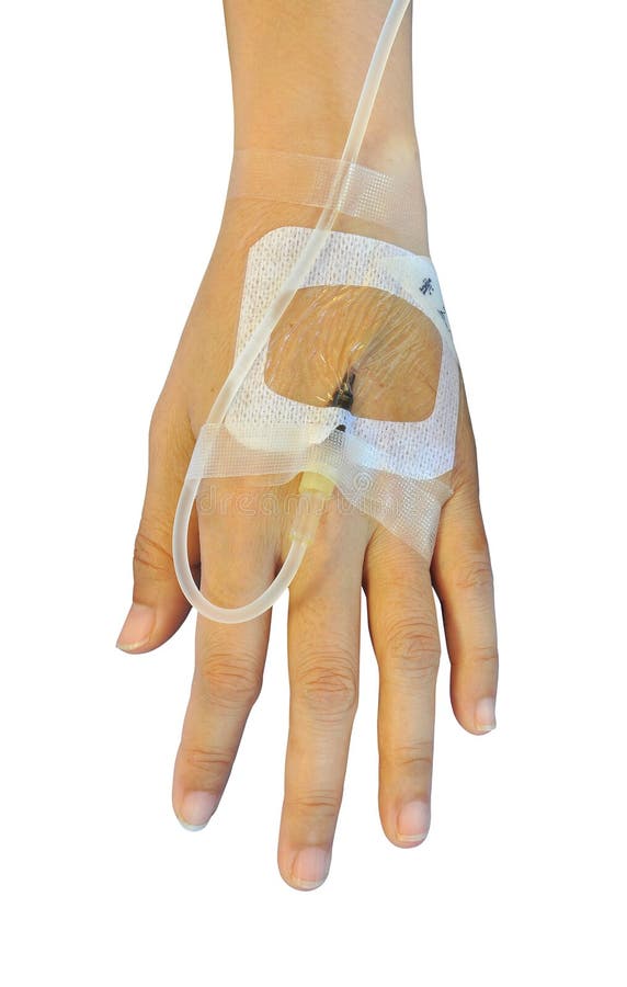 IV Solution in a Patients Hand Stock Image - Image of cancer, health ...
